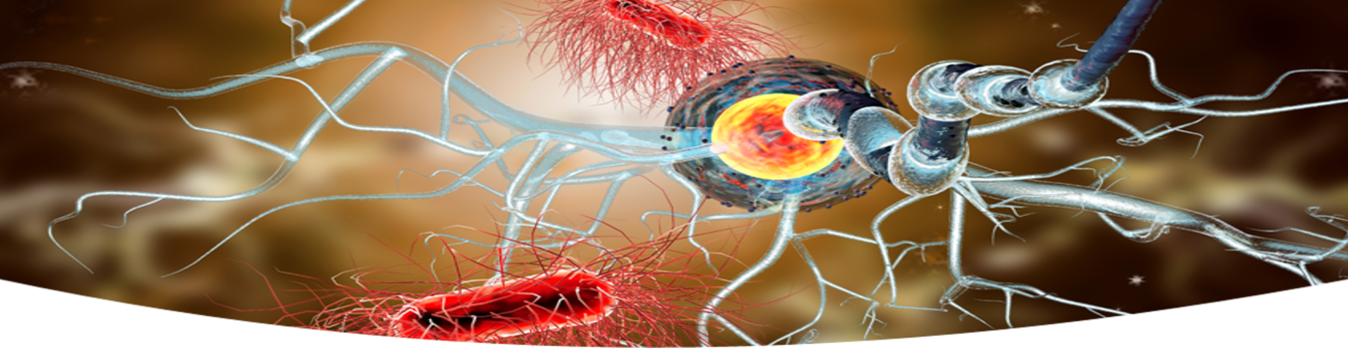 Multiple Sclerosis - Diagnosis | Optimum Neurology
